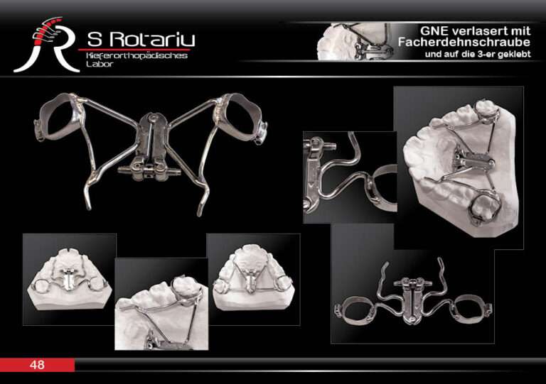 Kieferorthopädisches Labor - Qualität made in Schweiz